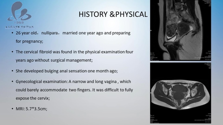 Transvaginal Natural Orifice Transluminal Endoscopic Myomectomy for ...