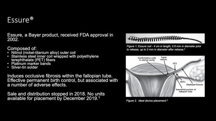 Laparoscopic EssureⓇ Removal with Cornual Wedge Resection - SurgeryU by ...