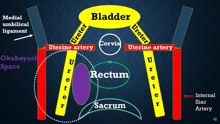 Exploring the Pararectal Space Made Simple - SurgeryU by AAGL