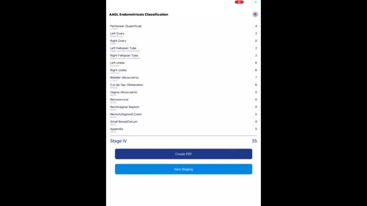 Application of AAGL Endometriosis Classification - An Innovative Tool ...