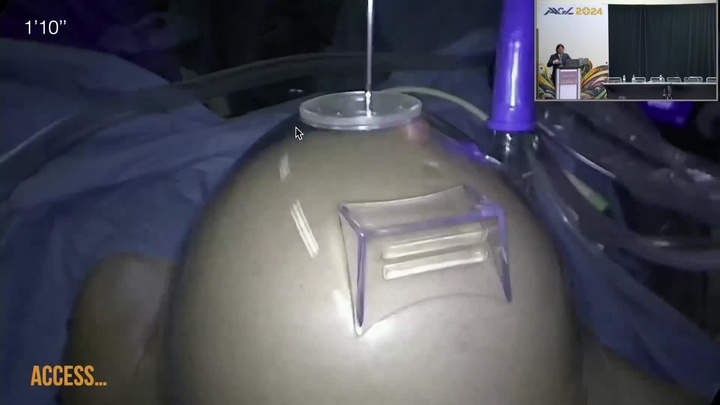 2024-11-17 - ENDO-707 - SurgeryU by AAGL