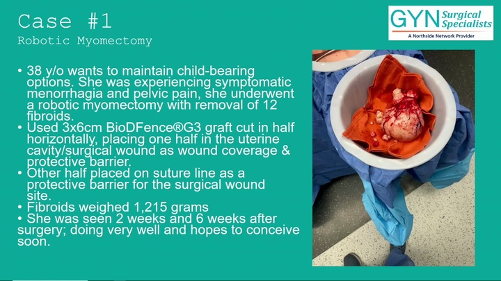 Integra LifeSciences - SurgeryU by AAGL