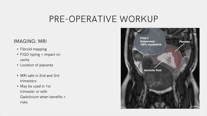Laparoscopic-Assisted Myomectomy during the Second Trimester of ...