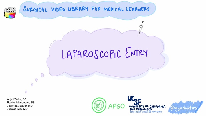 Surgical Video Library for Medical Learners: Laparoscopic Entry ...