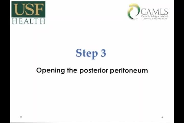 7 Steps to Total Laparoscopic Hysterectomy - SurgeryU by AAGL