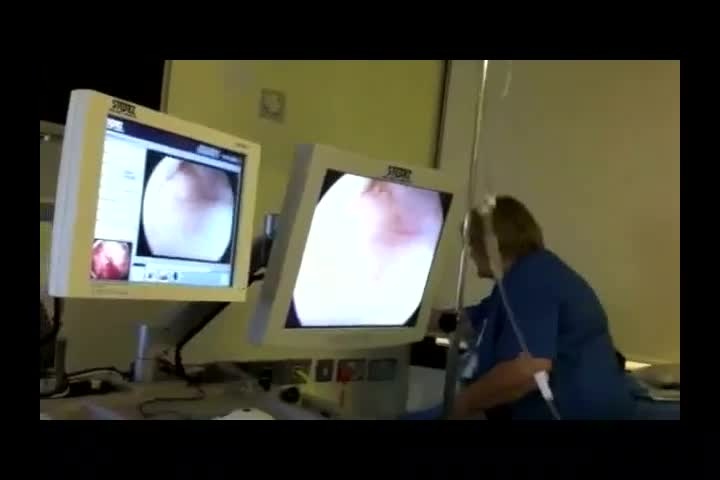 Outpatient Resection of Fibroid: A Patients View - SurgeryU by AAGL