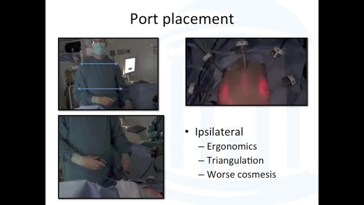 Laparoscopic Myomectomy: Tips and Tricks - SurgeryU by AAGL