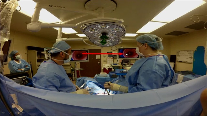 Step-by-Step Approach to Hysterectomy - SurgeryU by AAGL