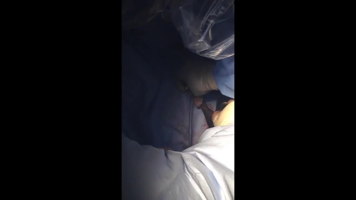 In-Bag Vaginal Morcellation for the Large Uterine Specimen Following ...