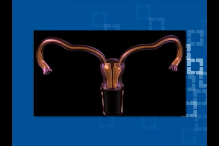 Uterine Septum: Reproductive Implications and Surgical Management ...