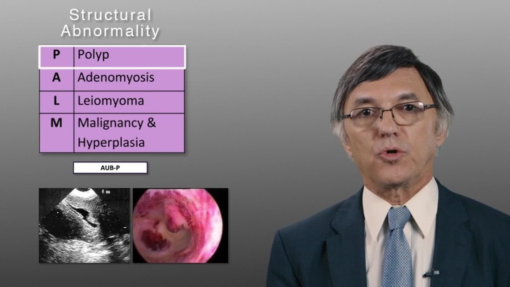 FIGO AUB System 2, the PALM-COEIN System for Classification of Causes ...